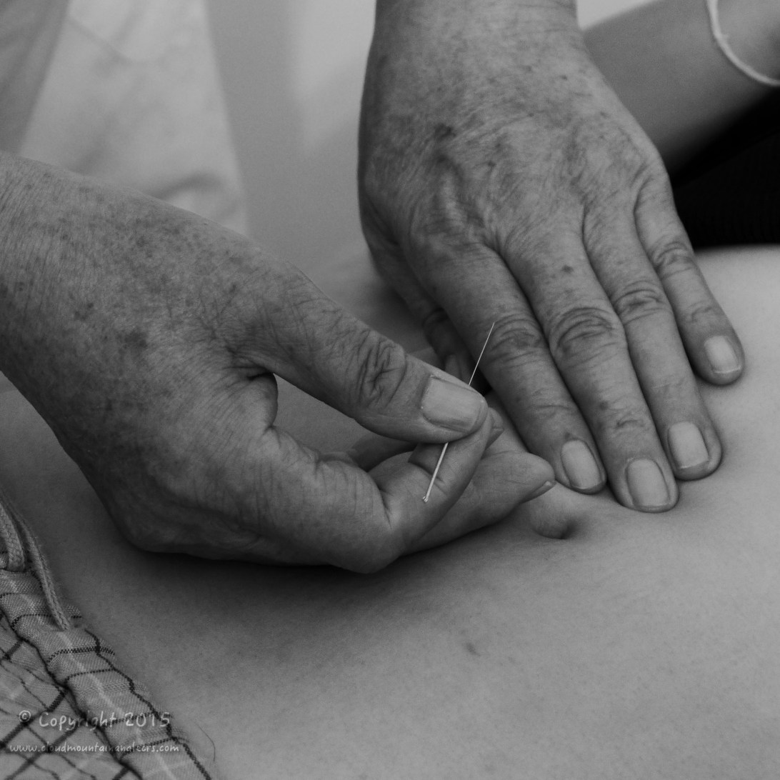 The Hands of An Old Acupuncture Doctor | Cloud Mountain Analects